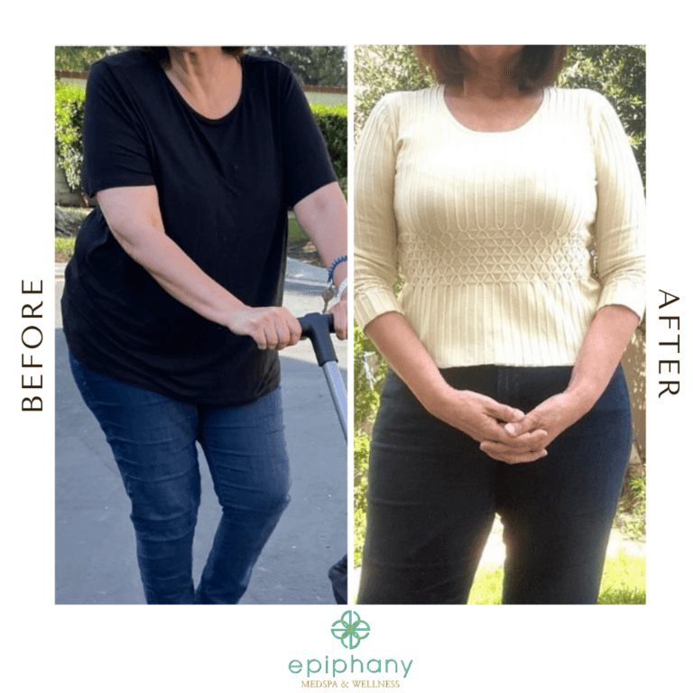 Gallery - Epiphany Medspa and Wellness