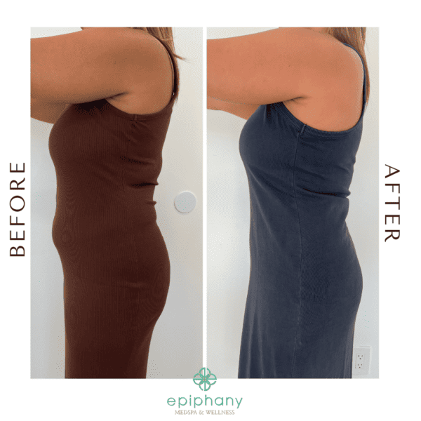 Gallery - Epiphany Medspa and Wellness